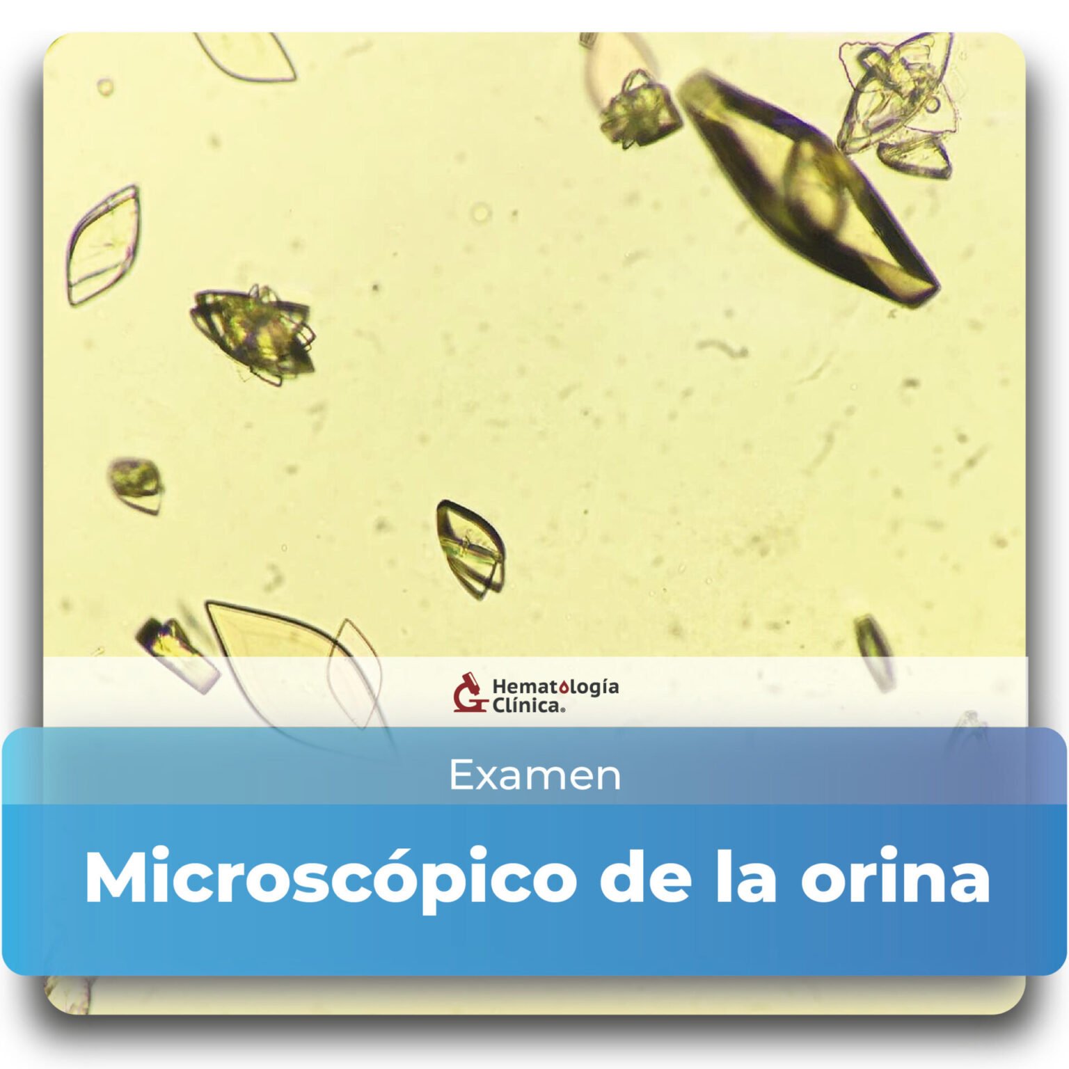 Examen microscópico de la orina (Junio 2025) - Hematología Clínica ...