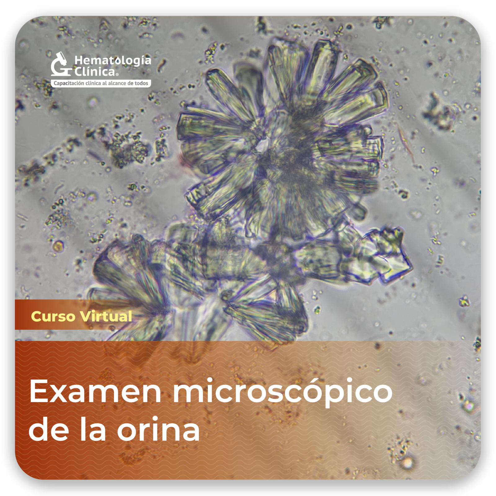 Examen microscópico de la orina (Febrero 2026) - Hematología Clínica ...